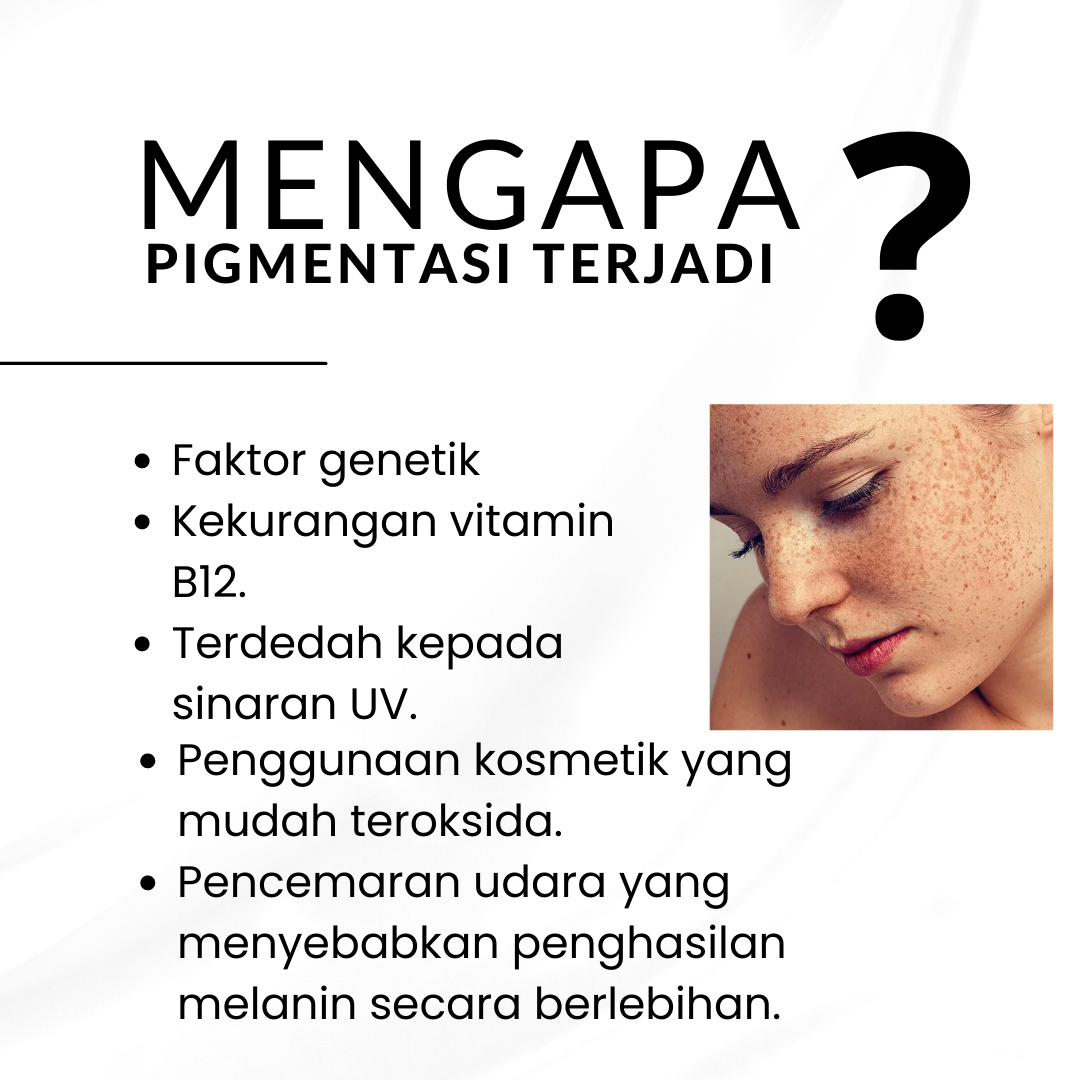 Set Jeragat: Anti-Pigmentation Celllora | Teknologi Stem Cell CIGF ...